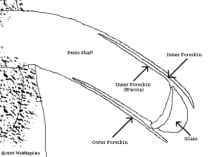 Stop Male Infant Genital Mutilation (Circumcision)