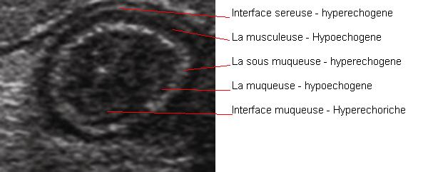Actualite de la medicine