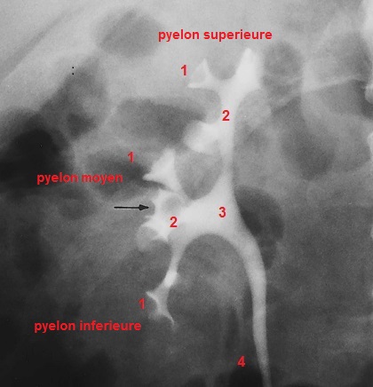 Actualite de la medicine