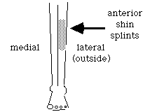 Anterior Shin Splints