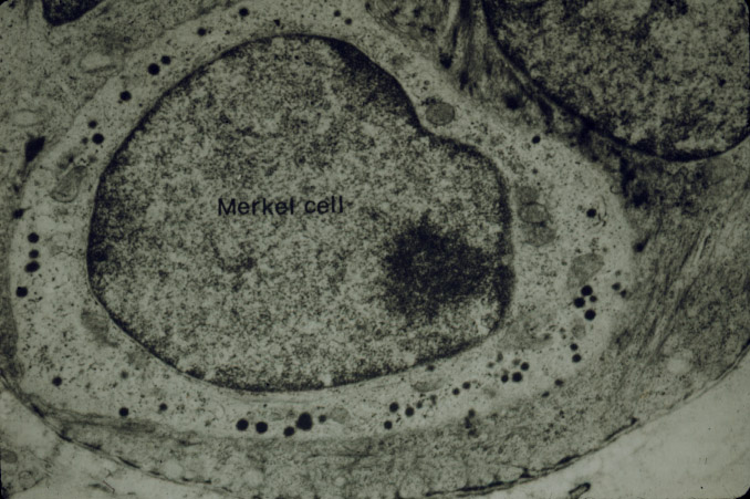 Células de Merkel
