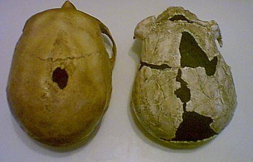 Kow Swamp Skeletons are they Homo erectus artificial cranial ...