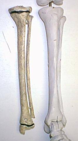 The Leg bones of Homo erectus Java man Trinil 2 femur OH 28 KNM-ER 1808 ...