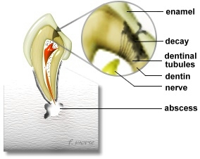 Inside a tooth