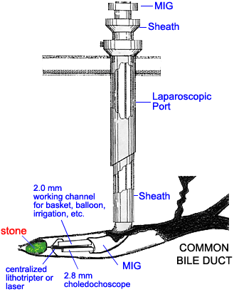Enhanced Laparoscopic