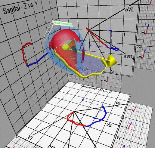 THE ECG IN 3D HEART TO LOOP TO LEADS